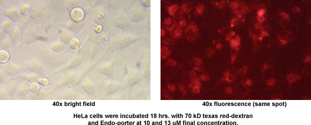Endo-Porter | Gene Tools, LLC
